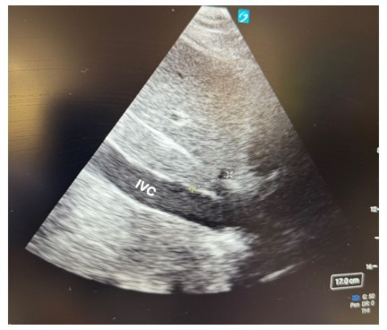 Invasive and non-invasive monitoring in the ICU | Trauma Surgery ...
