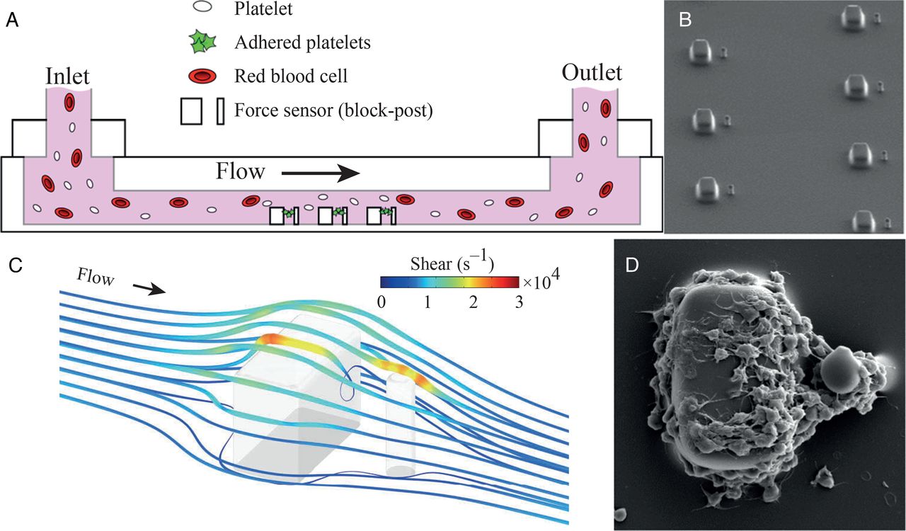 Using microfluidic shear to assess transfusion requirements in trauma ...