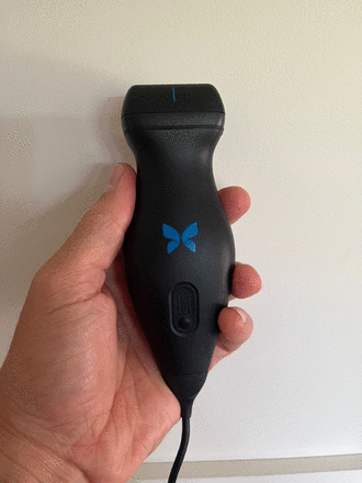 Feasibility of ultraportable US in detecting clinically concerning ...